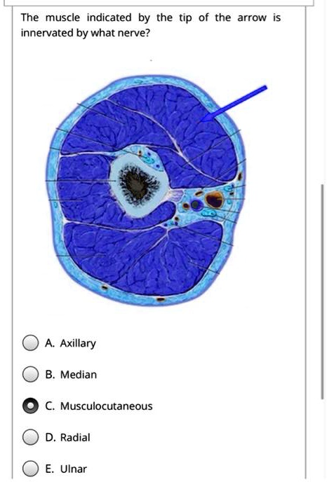 SOLVED: The muscle indicated by the tip of the arrow innervated by what ...