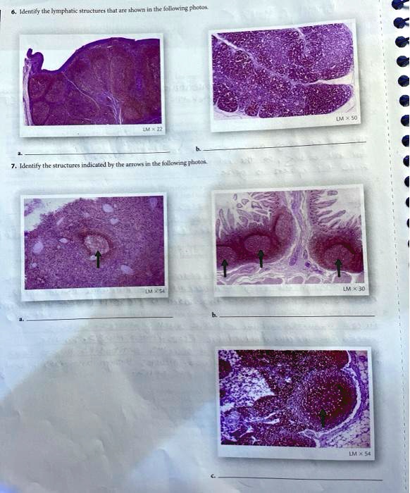 VIDEO solution: 6. Identify the lymphatic structures that are shown in ... VIDEO solution: 6. Identify the lymphatic structures that are shown in ...
