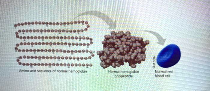 SOLVED:0099@ 8804988299808680000 Amino acid sequence Of normal ...