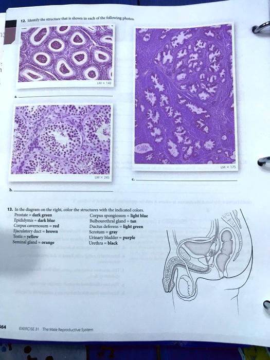 VIDEO solution: In the diagram on the right, color the structures with ...