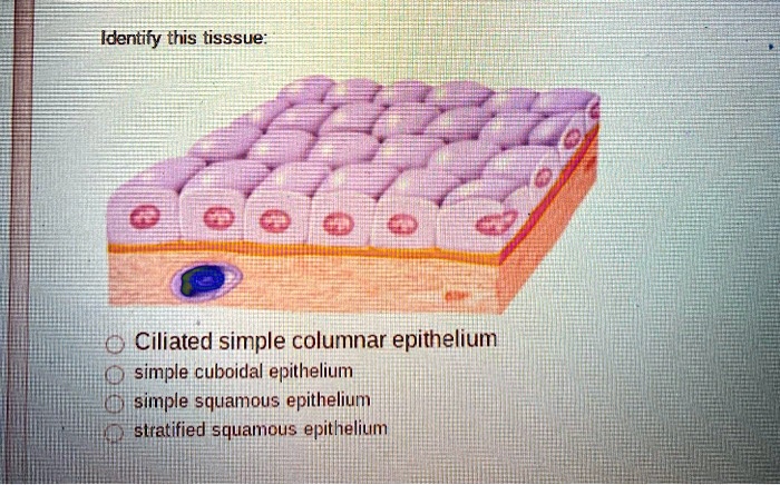 SOLVED: Identify this tisssue: 0 Ciliated simple columnar epithelium simple cuboidal epithelium ...