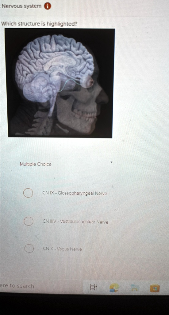 SOLVED: Nervous system Which structure is highlighted? Multiple Choice ...