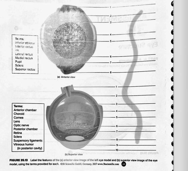 SOLVED: Texts: Terms: inferior oblique, inferior rectus, iris, lateral ...