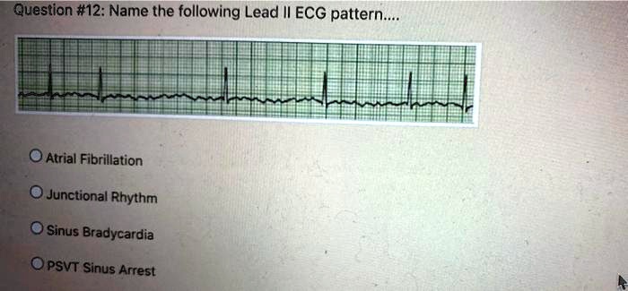 SOLVED: Question #12: Name the following Lead II ECG pattern Atrial ...