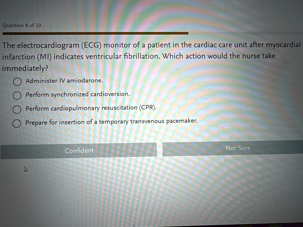 The electrocardiogram (ECG) monitor of a patient in the cardiac care ...