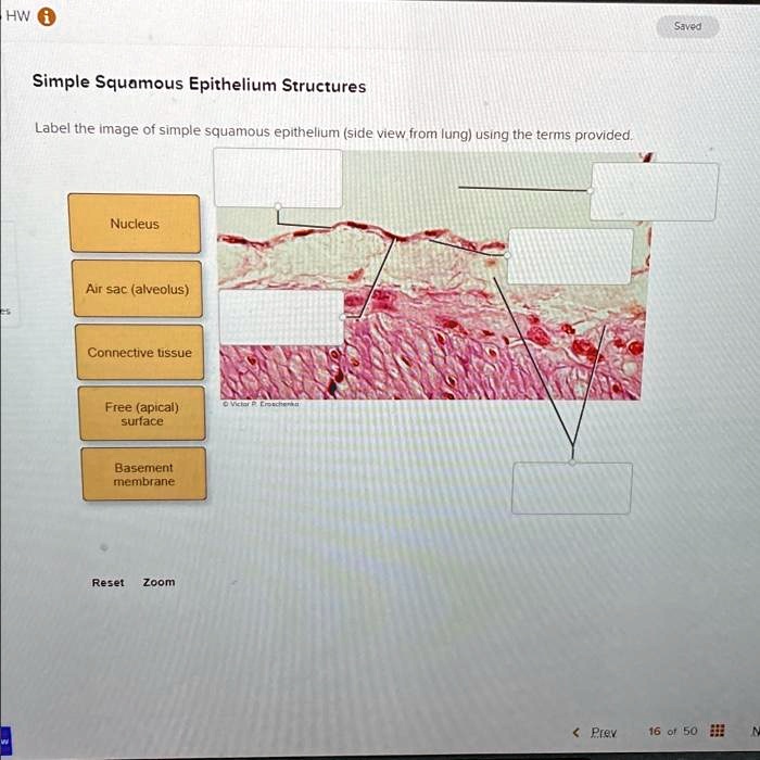 SOLVED: Texts: Label the image of simple squamous epithelium (side view ...