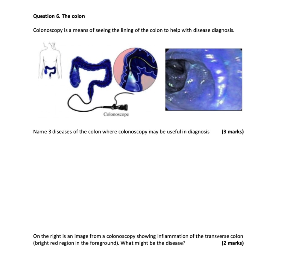 Question 6. The colon Colonoscopy is a means of seeing the lining of ...