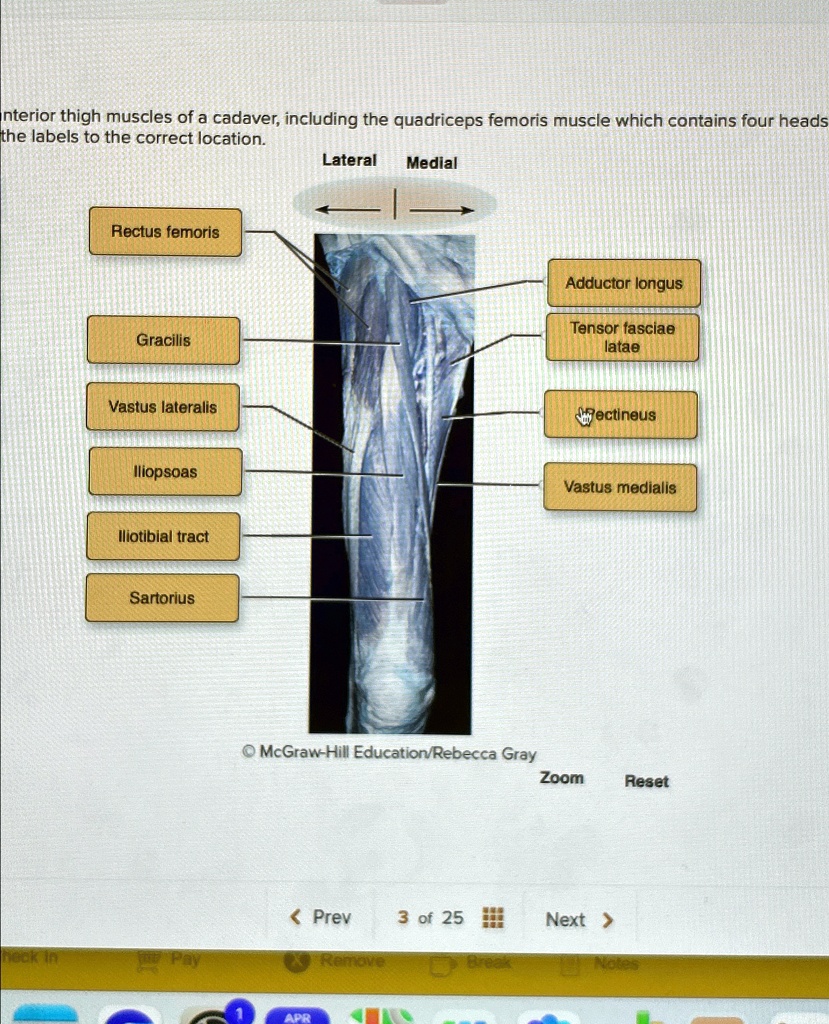 Interior thigh muscles of a cadaver, including the quadriceps femoris ...