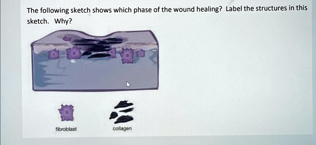 the following sketch shows which phase of the wound healing label the ...