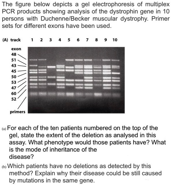 The figure below depicts a gel electrophoresis of multiplex PCR ...