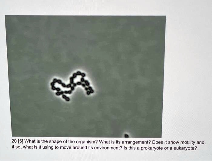 SOLVED: What is the shape of the organism? What is its arrangement ...