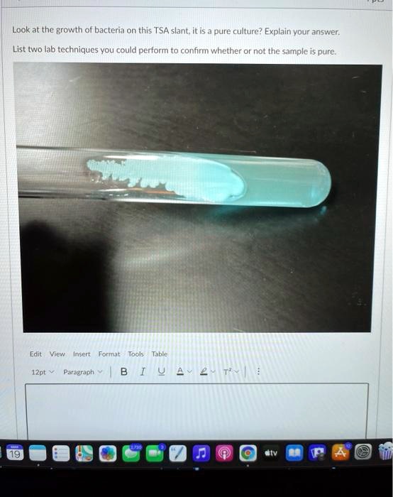 look at the growth of bacteria on this tsa slantitis pure culture ...