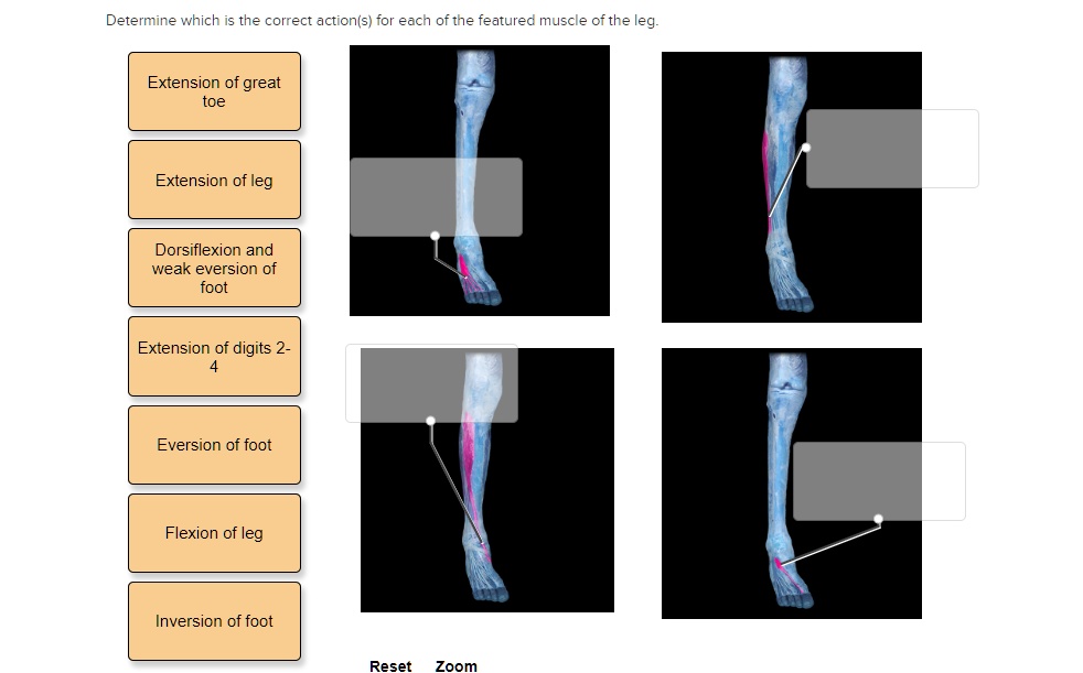 Determine which is the correct action(s) for each of the featured ...