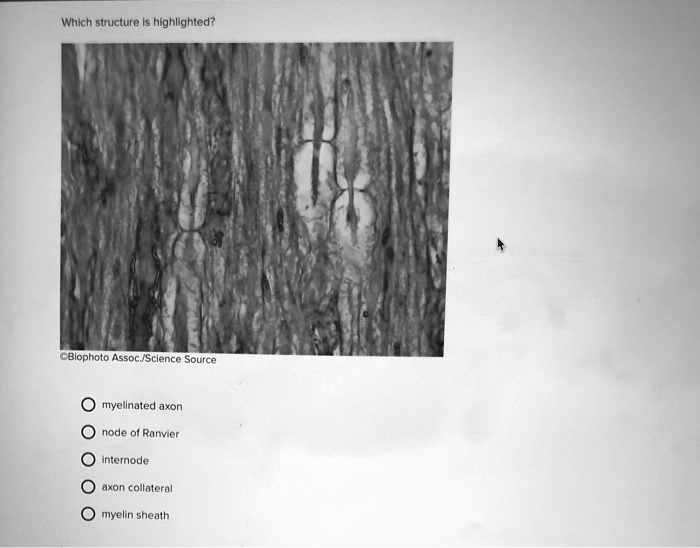 Which structure is highlighted? ©Biophoto Assoc./Science Source ...