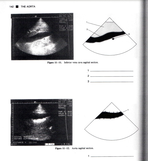 SOLVED: name the parts a6 142 THE AORTA Figure 1111.Inferior vena cava ...