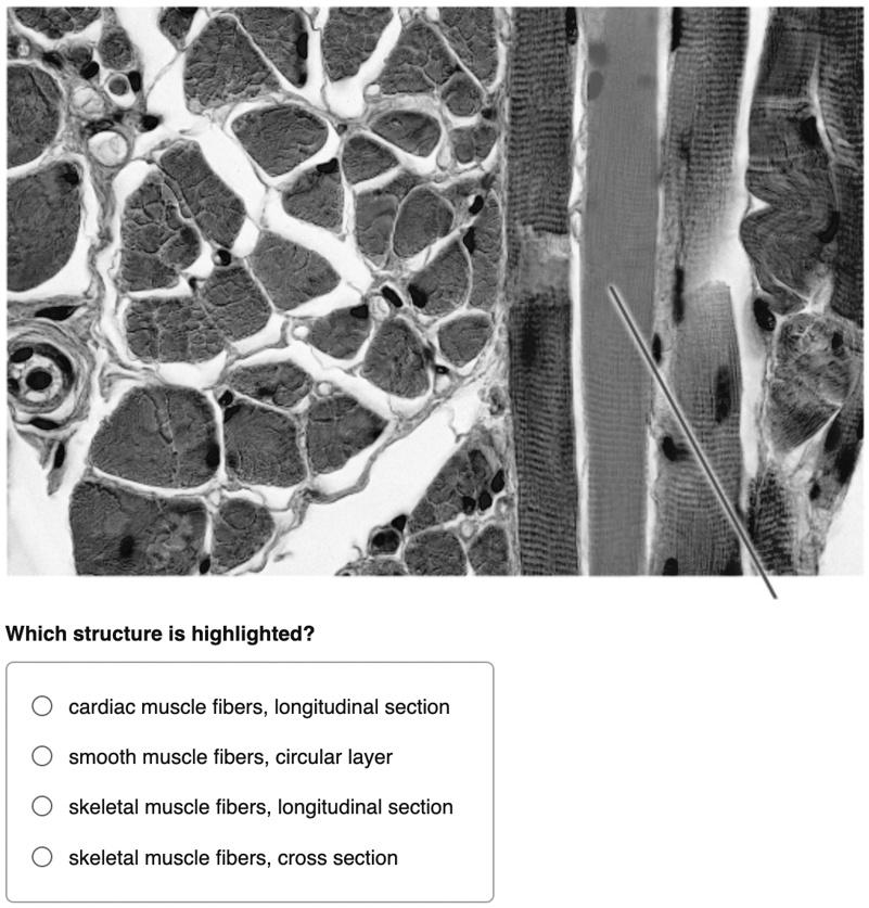 Which structure is highlighted? cardiac muscle fibers, longitudinal section smooth muscle fibers ...
