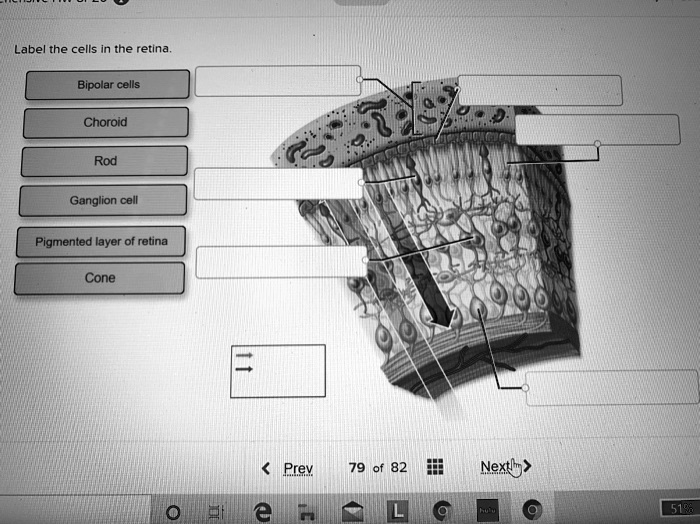 SOLVED: Label the cells in the retina. Bipolar cells Choroid Rod ...