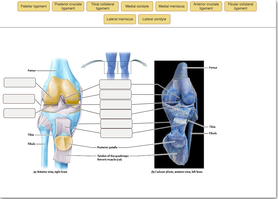 SOLVED: Anatomical structure of the knee joint (1 of 2) Patellar ...