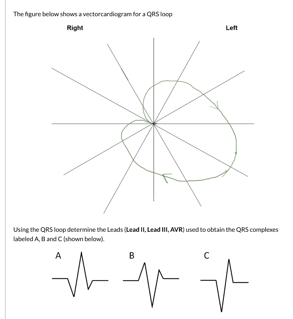 The figure below shows a vectorcardiogram for a QRS loop Right Left ...