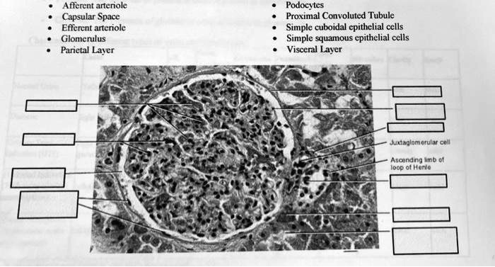 Afferent arteriole Capsular Space Efferent arteriole Glomerulus ...