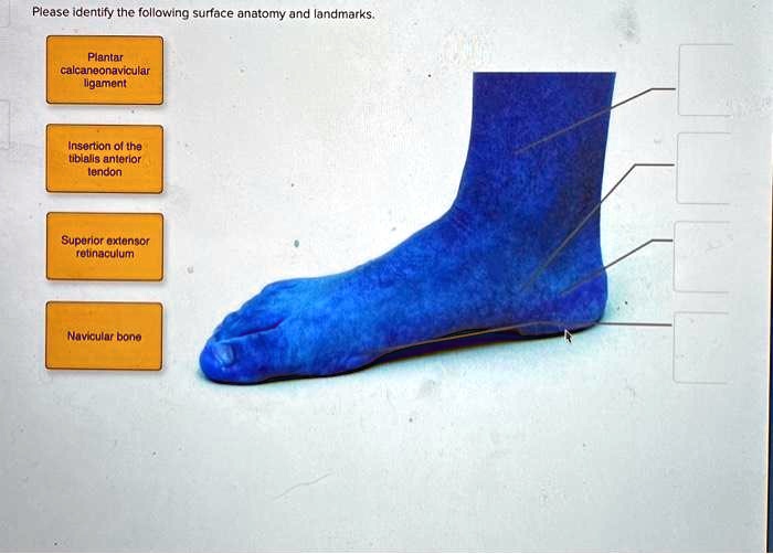 Please identify the following surface anatomy and landmarks. Plantar ...
