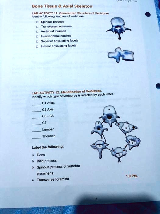 Bone Tissue Axial Skeleton LAB ACTIVITY 11: Generalized Structure of ...