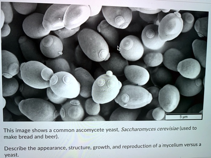 5 ?m This image shows a common ascomycete yeast, Saccharomyces ...