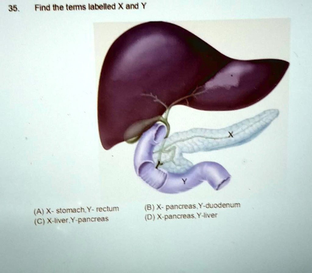 35. Find the terms labelled X and Y: (A) X - stomach, Y - rectum (B) X ...