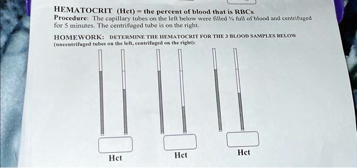 HEMATOCRIT (Hct) = the percent of blood that is RBCs Procedure: The ...