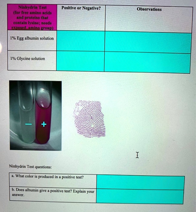 SOLVED: NinhydrIo Test (lor (rer amino adds and protelng that contaln ...