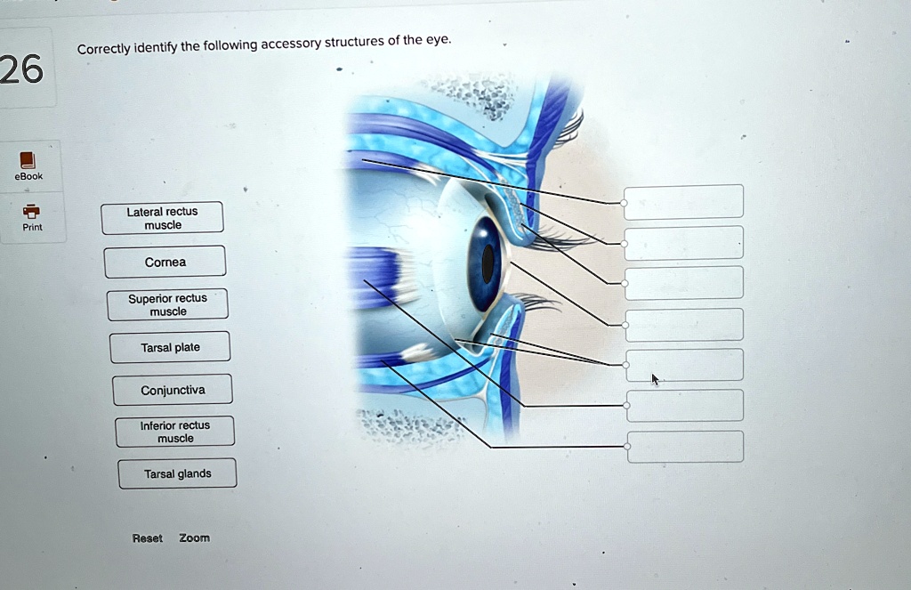 correctly identify the following accessory structures of the eye 26 ...
