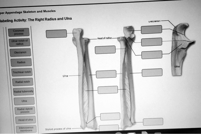 per Appendage Skeleton and Muscles labeling Activity: The Right Radius ...