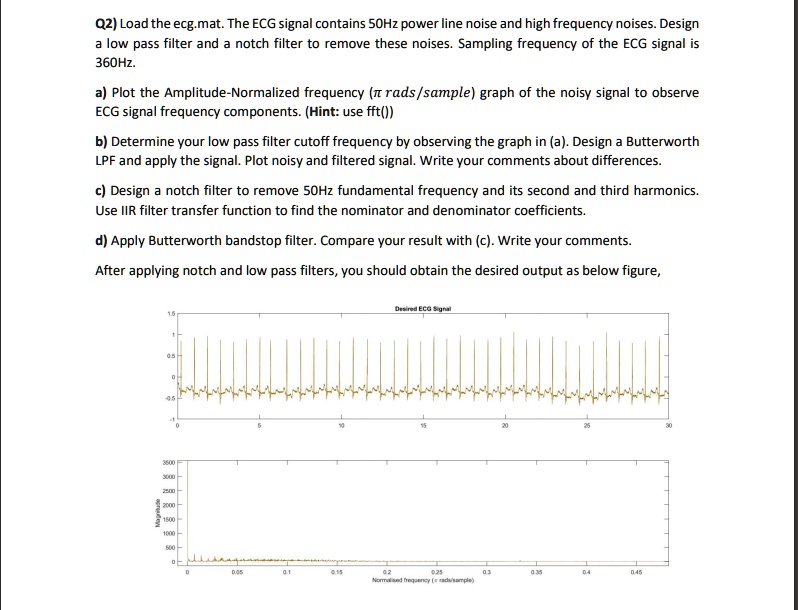 Q2) Load the ecg.mat. The ECG signal contains 50Hz power line noise and ...