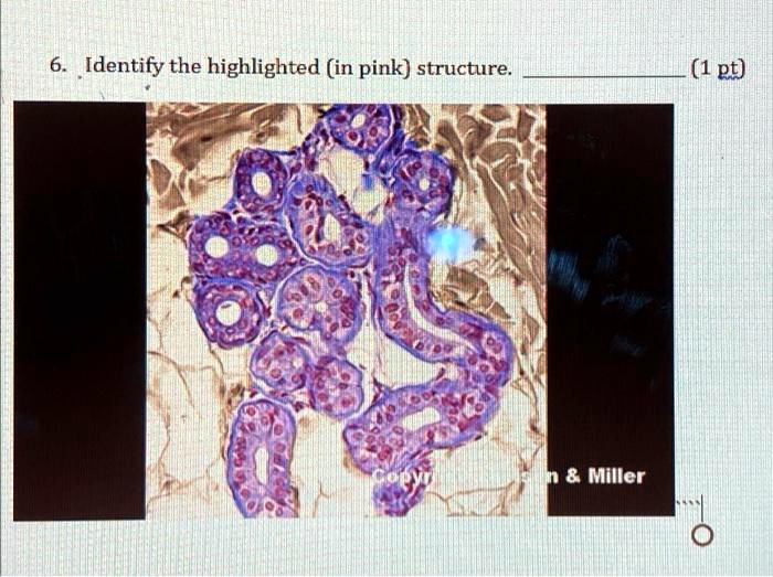 SOLVED: identify the highlighted (in pink) structure. 6Identify the ... SOLVED: identify the highlighted (in pink) structure. 6Identify the ...