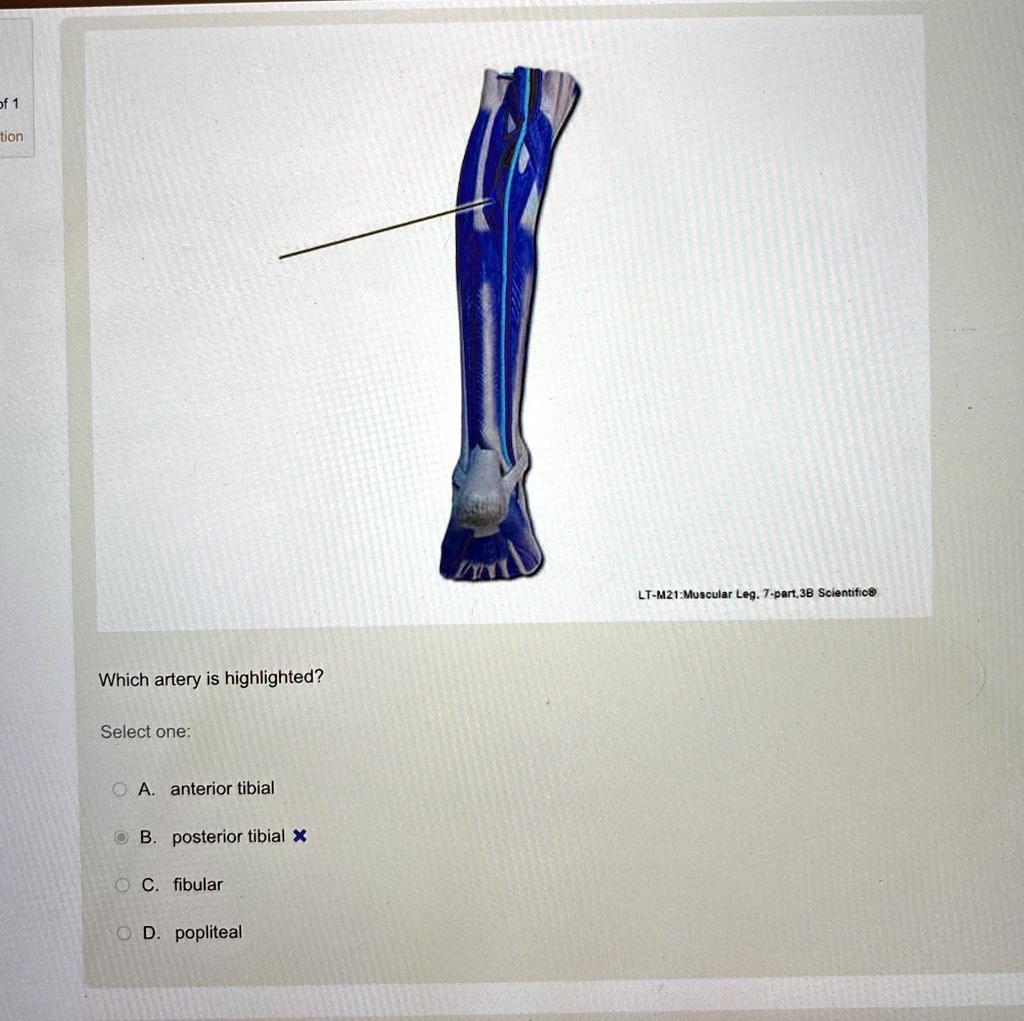 of 1 tion Which artery is highlighted? Select one: A. anterior tibial B ...