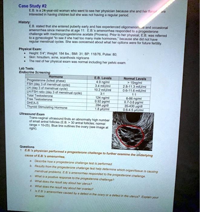SOLVED: Case Study #2 EB is a 24-year-old woman who went to see her ...