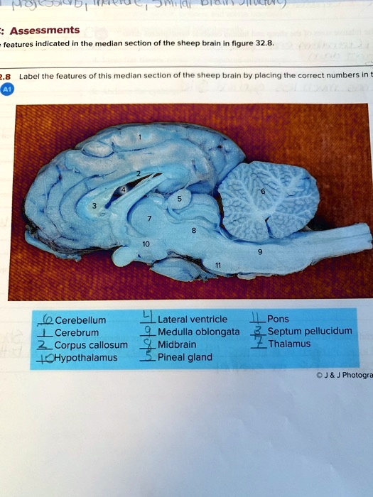 SOLVED: label the features of this median section of the sheep brain by ...