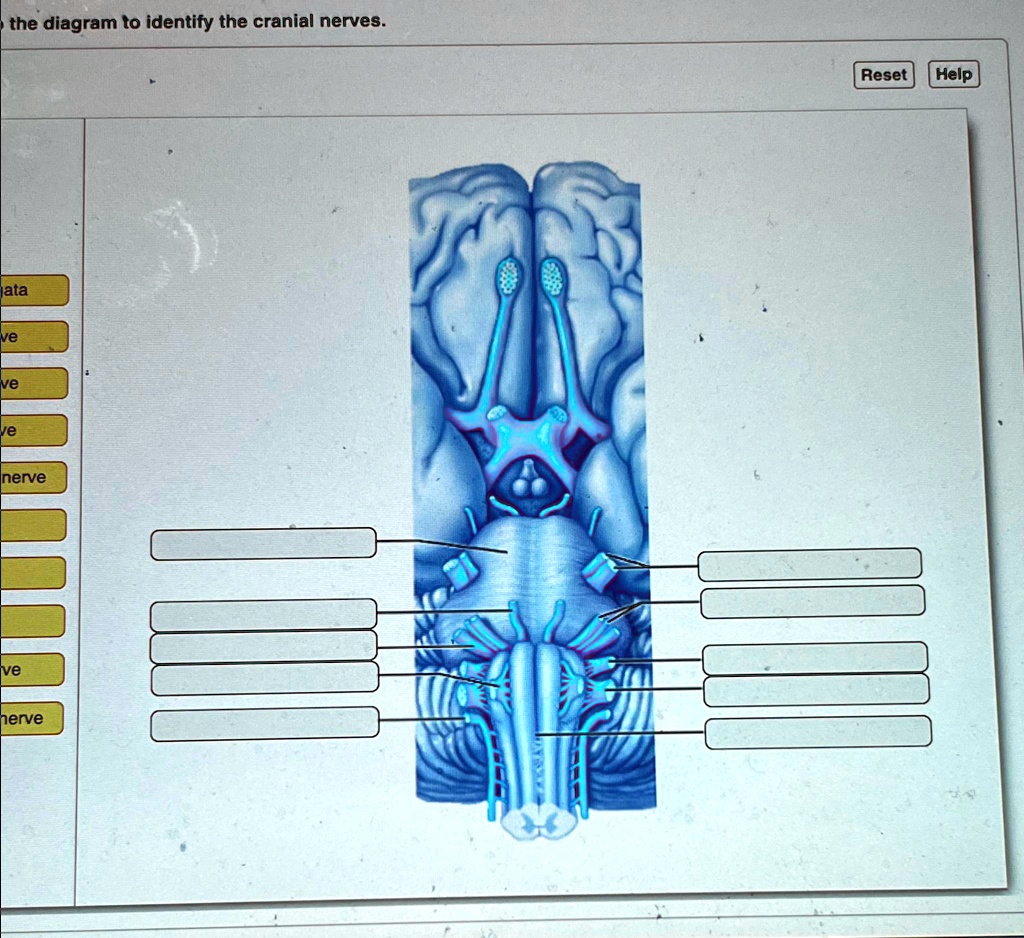 SOLVED: the diagram to identify the cranial nerves. the diagram to ...