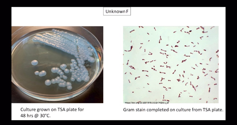 select the two unknown bacterial species that your unknown could be ...