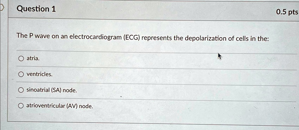 The P wave on an electrocardiogram (ECG) represents the depolarization ...