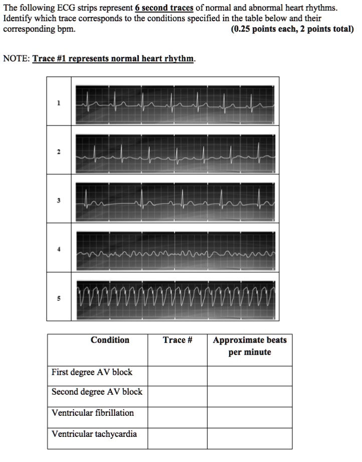 SOLVED: Texts: The following ECG strips represent 6-second traces of ...