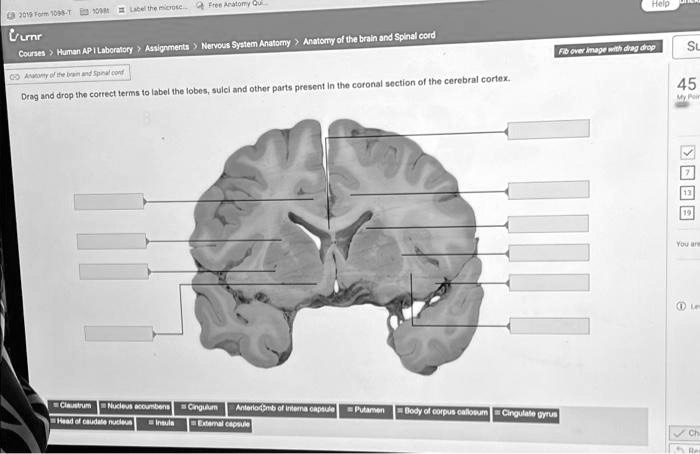 Courses > Human AP I Laboratory > Assignments > Nervous System Anatomy ...