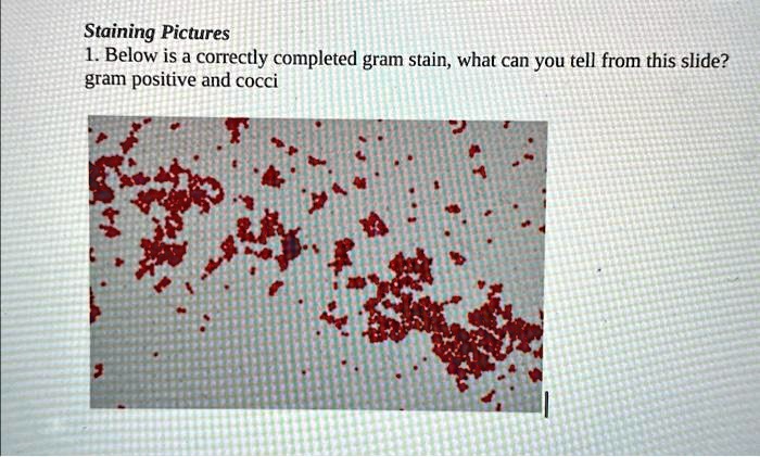 Staining Pictures 1. Below is a correctly completed gram stain, what ...