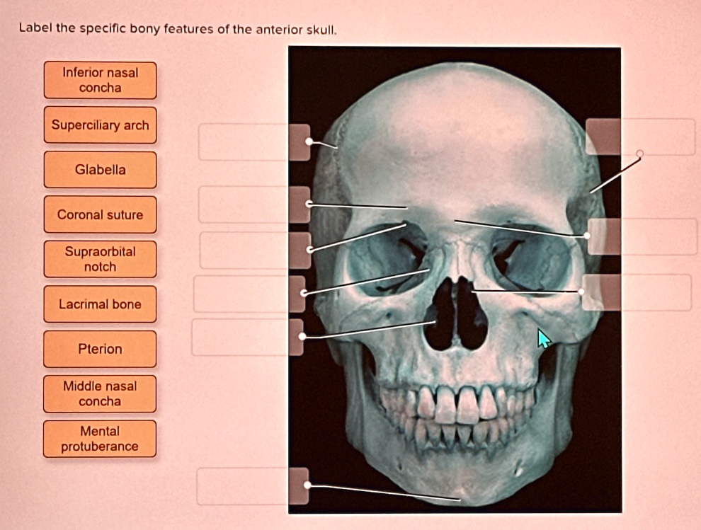 label the specific bony features of the anterior skull inferior nasal ...