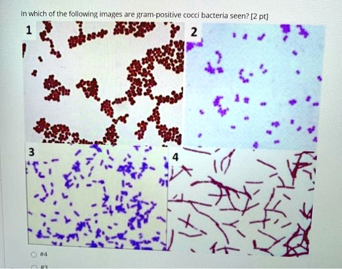 SOLVED: In which of the following images are gram-positive cocci ...