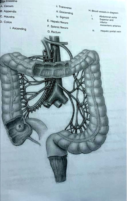 arge Intestine A. Cecum B. Appendix C. Haustra D. Colon i. Ascending ii ...