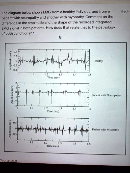 SOLVED: The diagram below shows EMG from a healthy individual and from ...