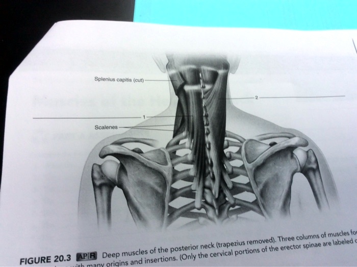 SOLVED: Splenius capitis (cut) Scalenes FIGURE 20.3 APIRDeep muscles of ...