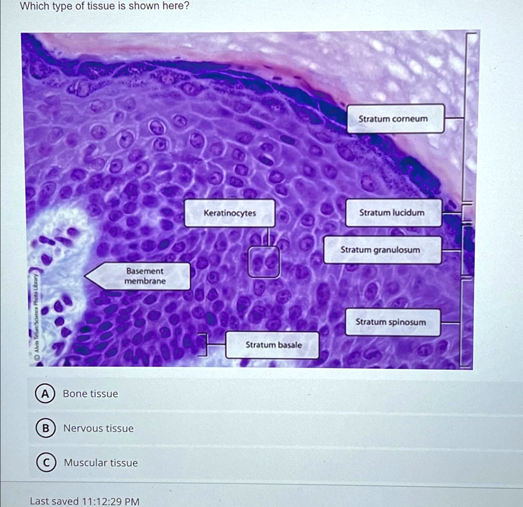 Which type of tissue is shown here? A Bone tissue B Nervous tissue C ...