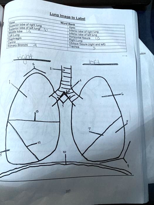 Solved Lung Image To Label Word Bank Apex Inferiorlobe Of Right Lung Inferior Lobe Of Left Lung
